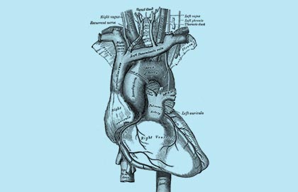 Aortic Arch Surgery - Sydney Heart and Lung
