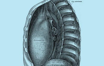 Mediastinal & Thymic Surgery - Sydney Heart and Lung