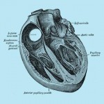 Minimally Invasive Mitral Valve Surgery (mini-Mitral) - Sydney Heart ...