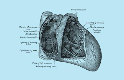 Septal Myectomy for Hypertrophic Cardiomyopathy - Sydney Heart and Lung